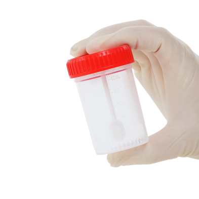 Stool Specimen Container with Spoon, Sterile Dynarex Corporation